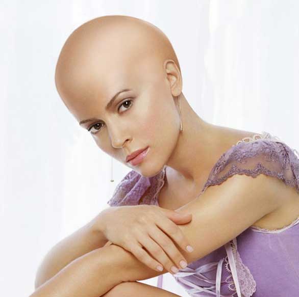 bald-alyssa-milano - WorldWideInterweb