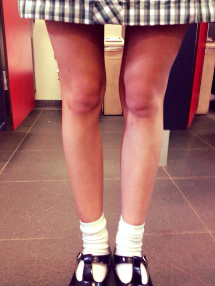 celebrity knee faces - WorldWideInterweb